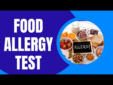 Food allergy vs Food intolerance | Symptoms | Causes | Tests| RAST |Top 9 Most Common Food Allergens