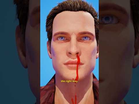 First Aid for Nosebleeds 🩸