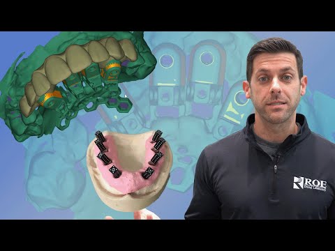How Does Grammetry Stack Up Against Photogrammetry?