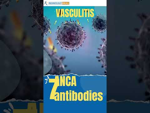 10 Laboratory Tests To Diagnose Autoimmune Diseases