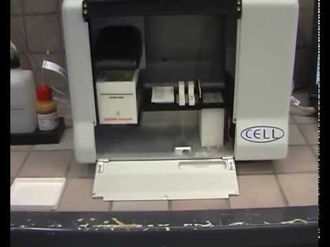 Clinical Electrophoresis Analyzer - Electrophoresis Automated System ...