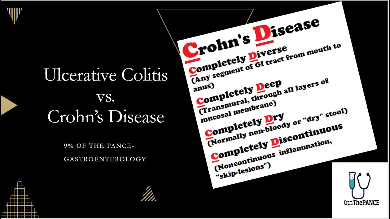 Understanding Ulcerative Colitis and Crohn's Disease: Key Differences ...