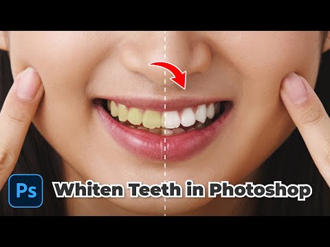 Easy For Beginners! How to Whiten Teeth in Photoshop