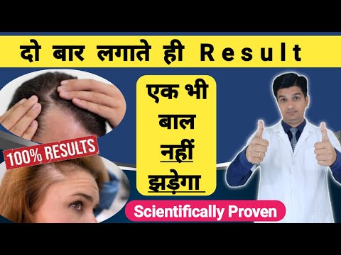 Minoxidil Finasteride Topical Solution - Minoxidil Finasteride Solution ...