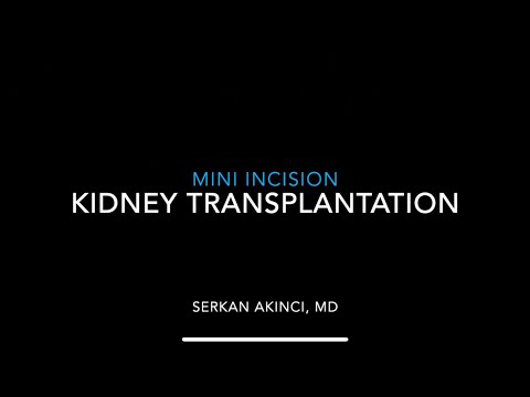 Mini Incision Kidney Transplantation