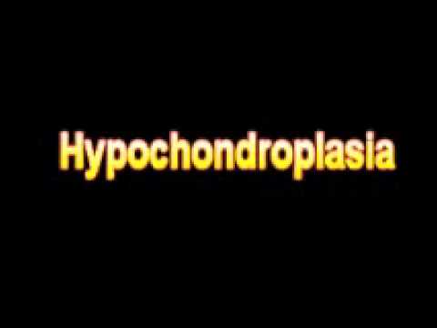 What Is The Definition Of Hypochondroplasia - Medical Dictionary Free Online Terms