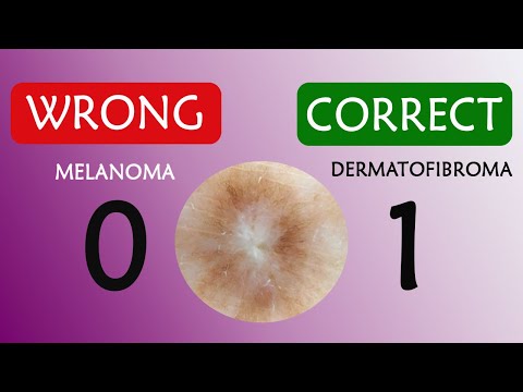 Dermoscopy Exam: Test Your Skills Right Now!