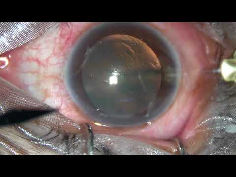 Doxercalciferol Injection at Best Price in India