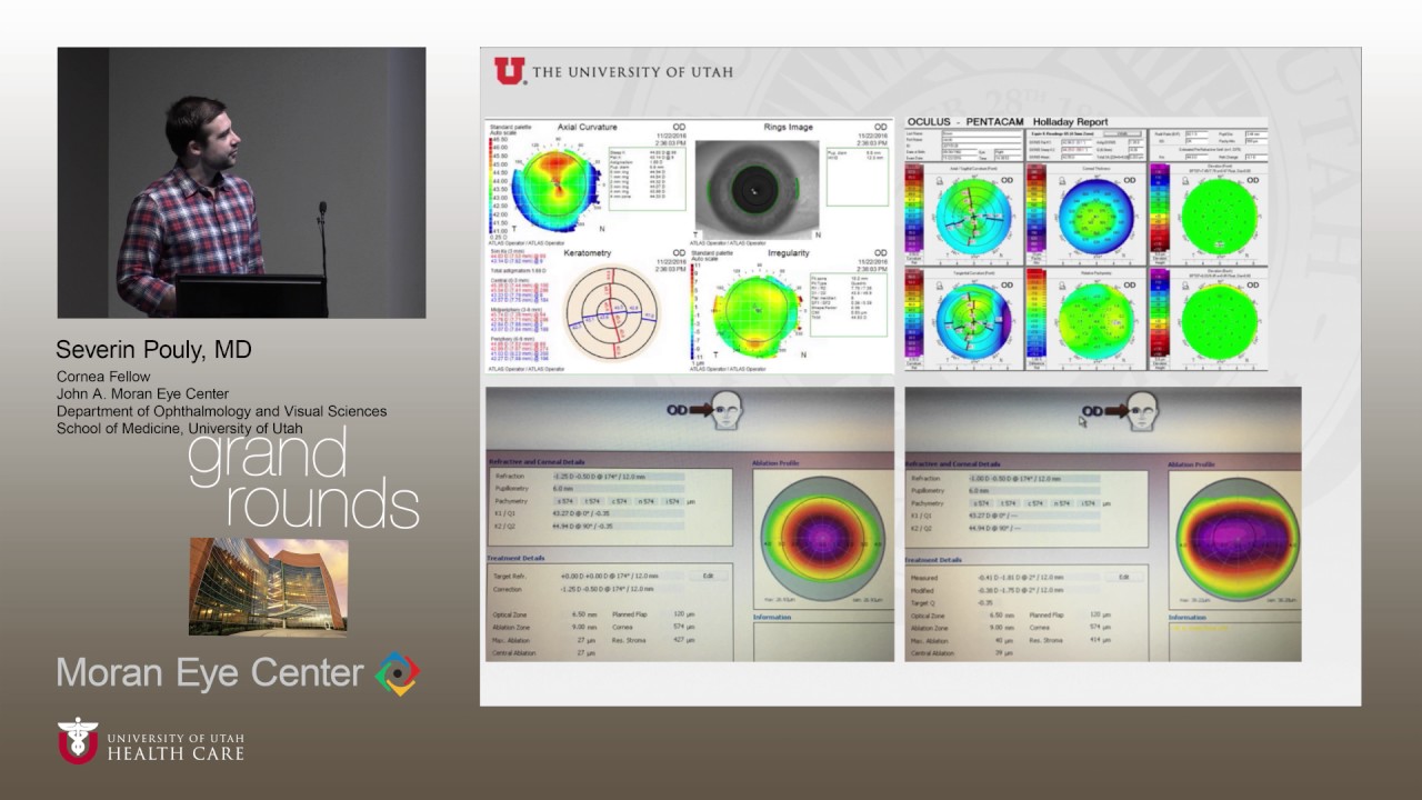 The Latest in Cornea