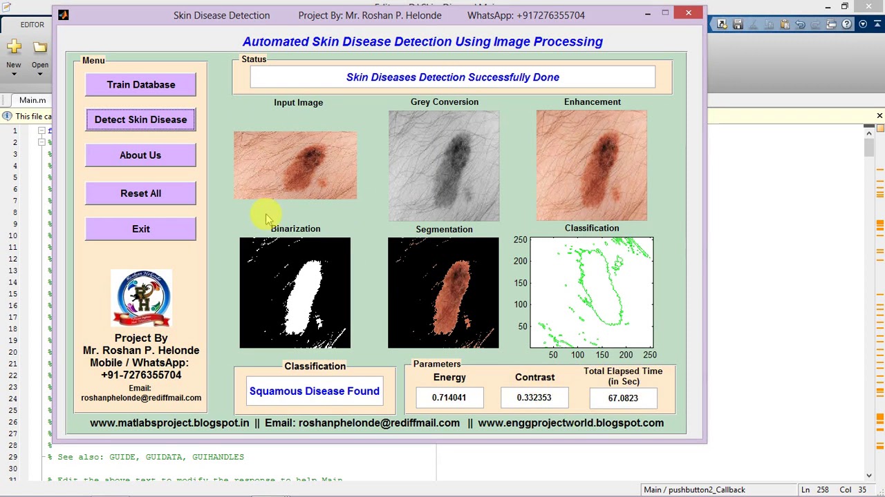 Skin Disease Detection using Image Processing Matlab Project Code