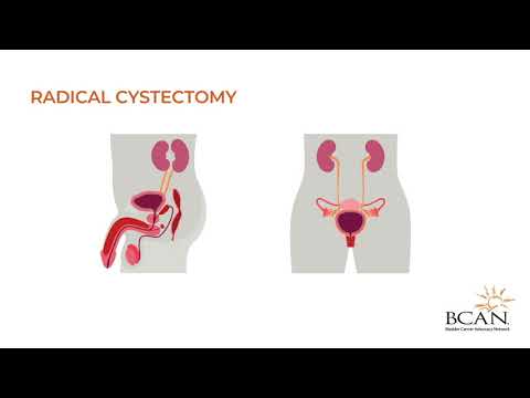 What is a cystectomy?