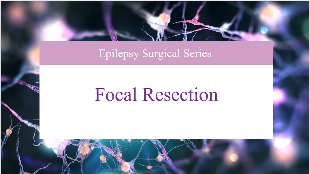 Epilepsy Video Resource Library | Education, Support & Stories