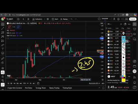 MBOT Stock (Microbot Medical stock analysis) MBOT STOCK PREDICTION MBOT STOCK analysis MBOT stock