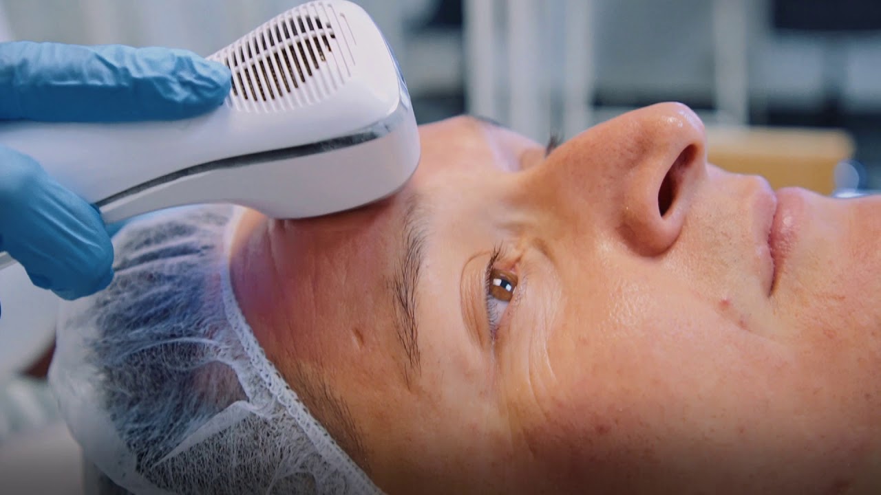 Micro Facial – CENTROS BLINK