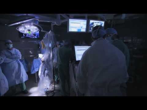 Value of CNS