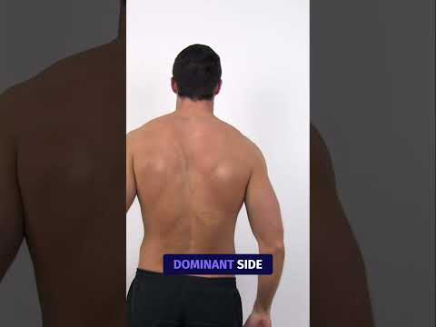 Apley Scratch Test or Dawbarn's Test⎟Shoulder ROM