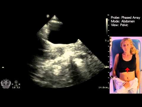 FAST Scan (Female Considerations)