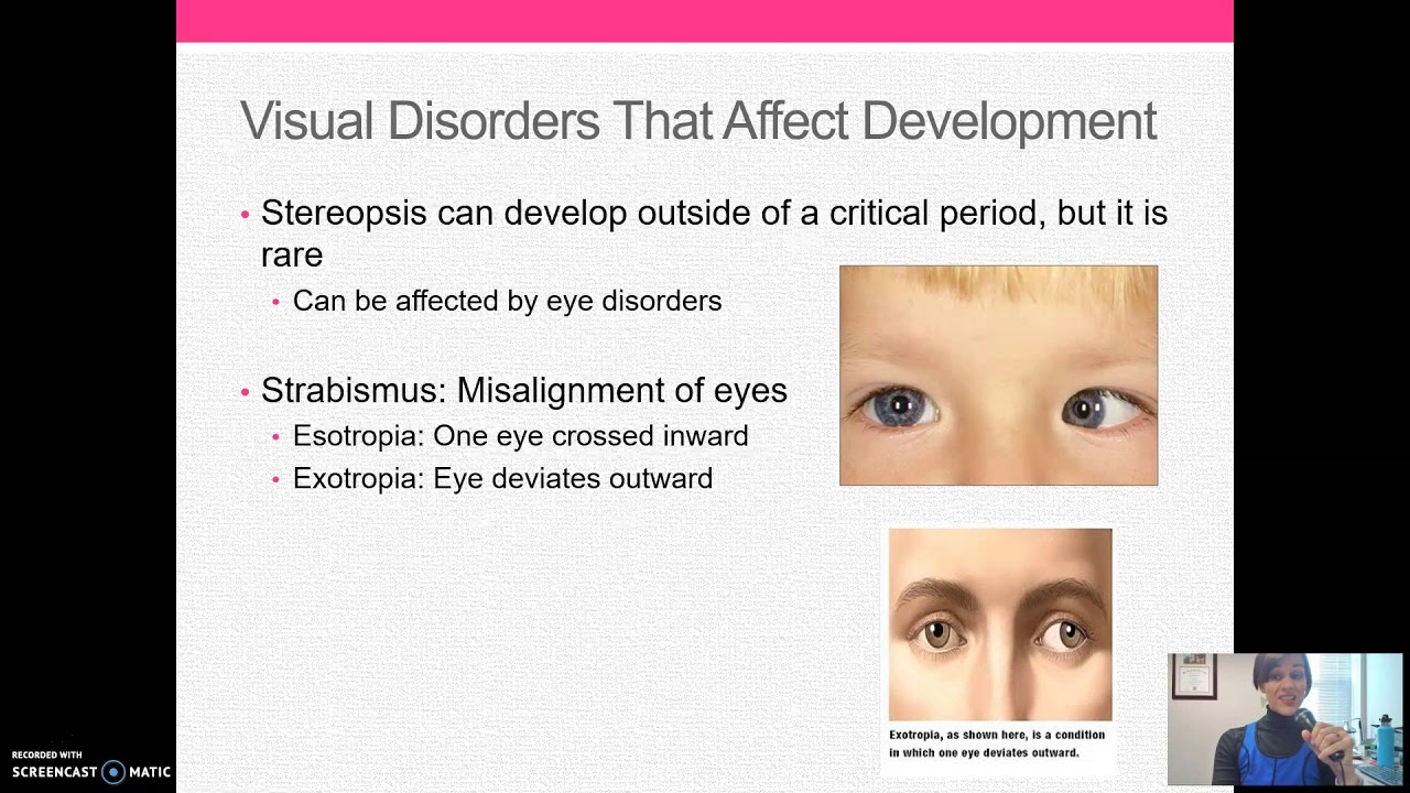Sensation and Perception: Developing Stereopsis