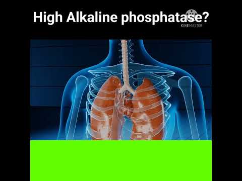 what is High Alkaline phosphatase? #shorts #highalkalinephosphatase #bloodtest #facts #seicnce
