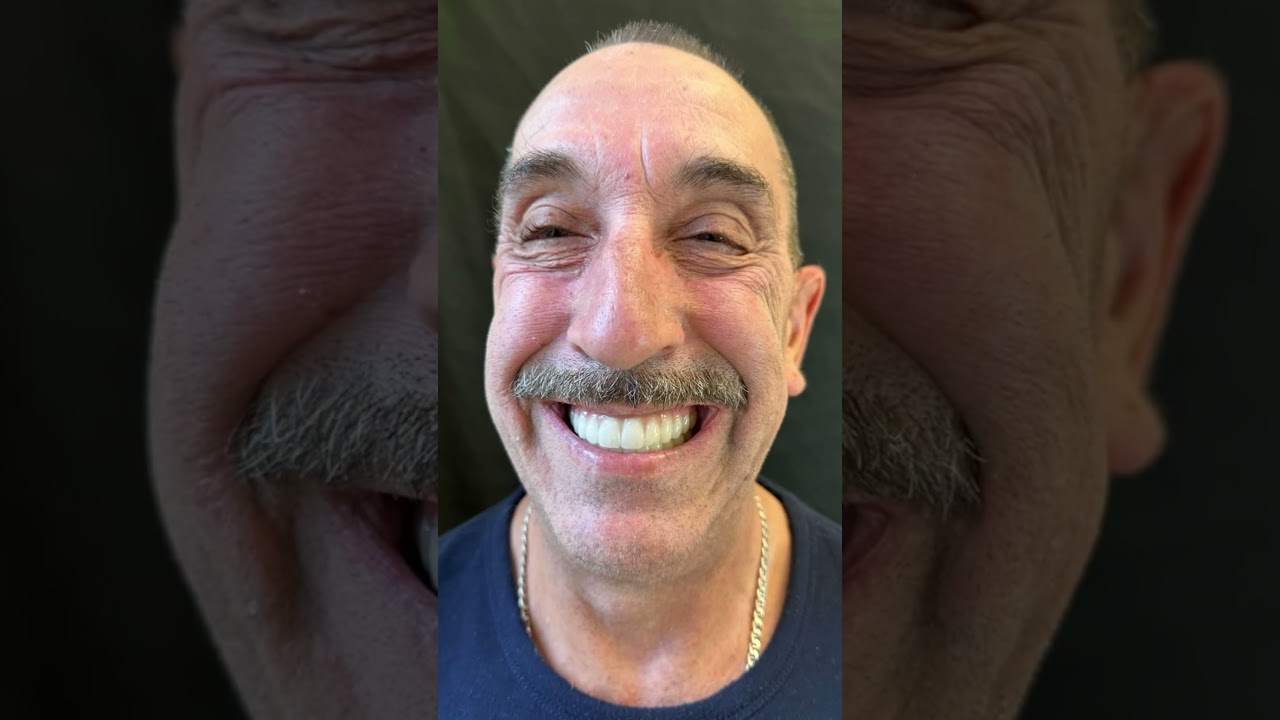 All-on-4 Dental Implants: Incredible Smile Transformation!