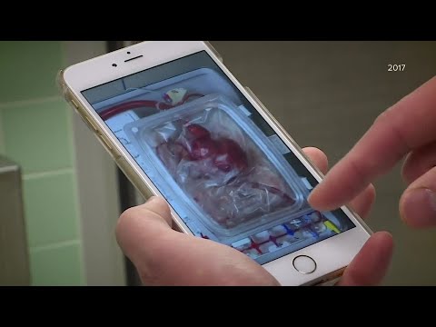 Your Healthy Family: FDA gives approval for game changing heart transplant device