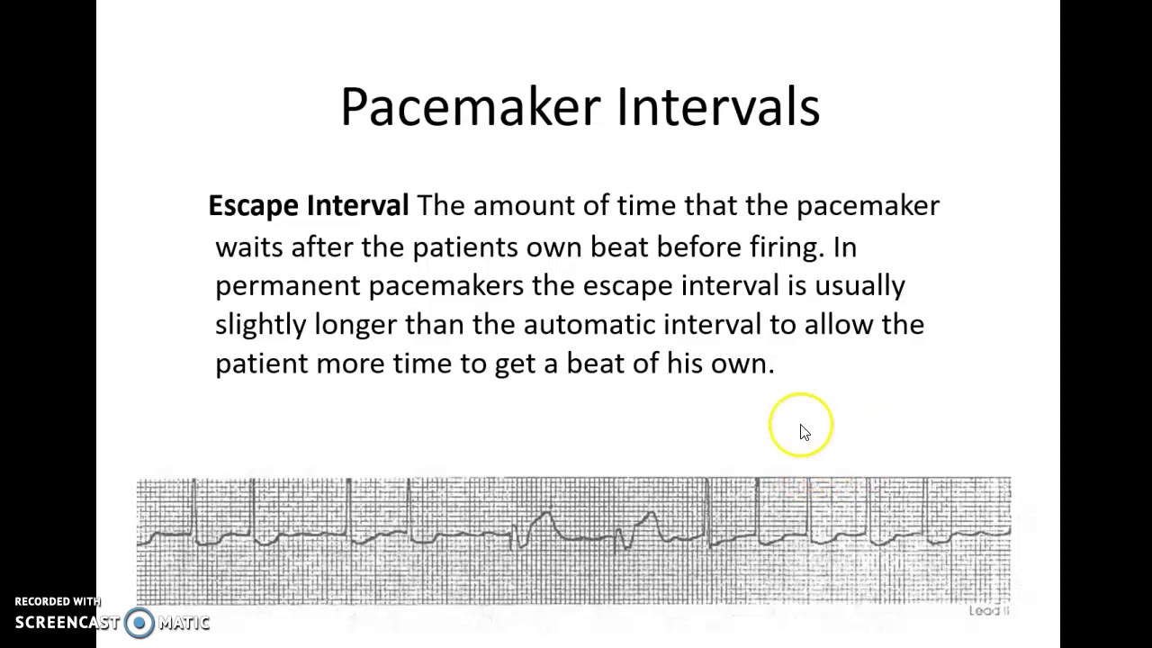 Paced Rhythms part 2