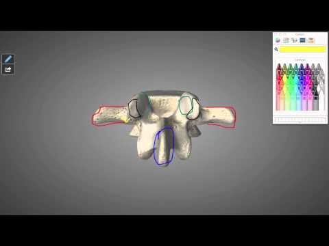 Typical Lumbar Vertebra Tutorial