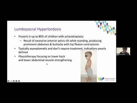 OrthoFracs Achondroplasia Summary by Dr Muqtasid Hussaini
