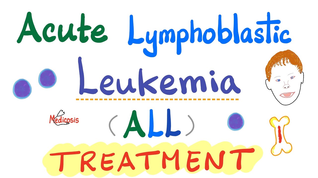 Acute Lymphoblastic Leukemia (ALL) - Treatment