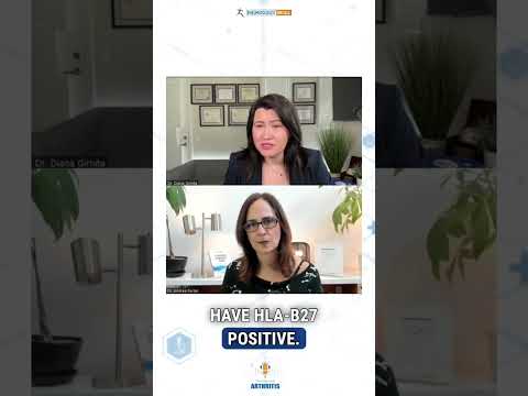 Understanding the complexities of Ankylosing Spondylitis