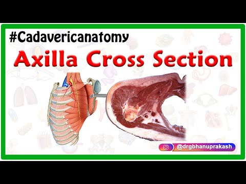 Anatomy of Axilla cross section / Cadaveric Anatomy - Boundaries and Contents - USMLE Step 1