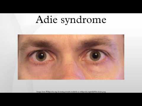 Adie syndrome