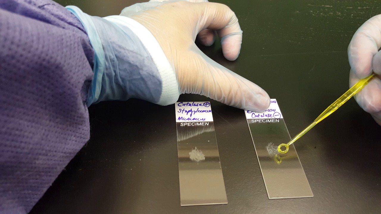 Microbiology: the Catalase test