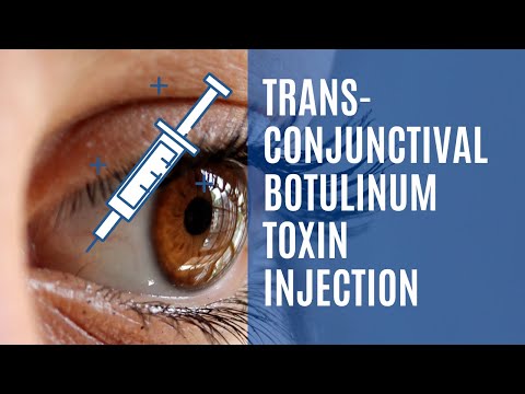 BOTOX Injection to treat Squint – Dr Mayank Jain, MD