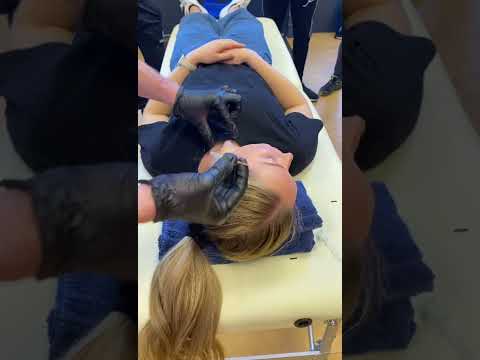 Dry needling to the sternocleidomastoid muscle