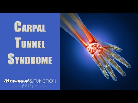 Exercises, Bracing, Posture and Stretching | Carpal Tunnel Treatment