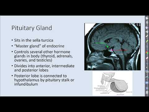 Pituitary, IAC’s, Orbits 07 22 19