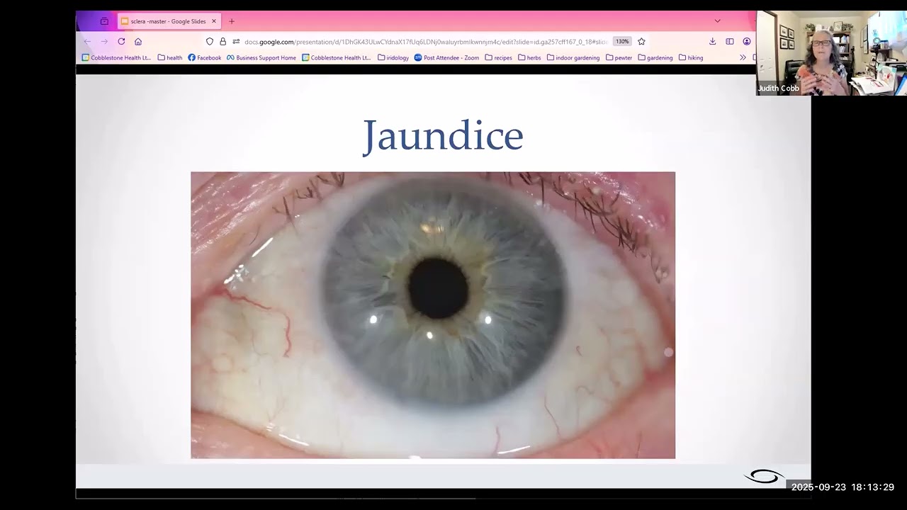 Sclerology Intro
