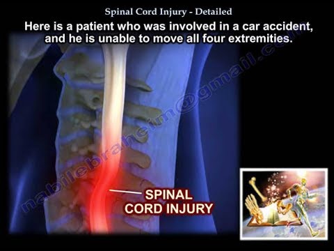 Spinal Cord Injury, Detailed - Everything You Need To Know - Dr. Nabil Ebraheim