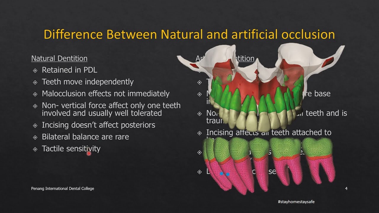 NATURAL & ARTIFICAL OCCLUSION