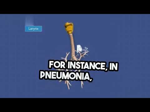 AirBronchogram