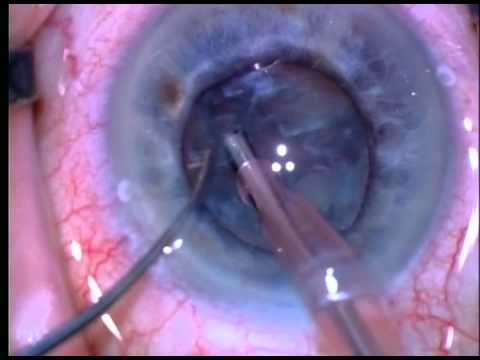 RHO PES OmiridiaToricOD