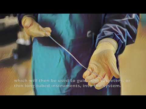 IVC Filter Placement