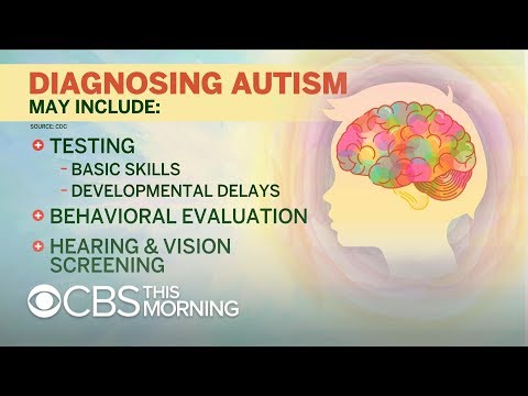 Autism can be diagnosed as early as 14 months, study suggests
