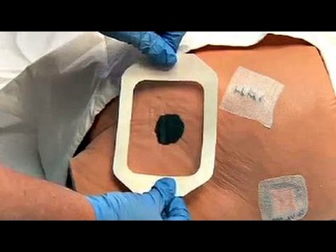 Adhesive Wound Dressing - adhesive dressing Latest Price, Manufacturers ...