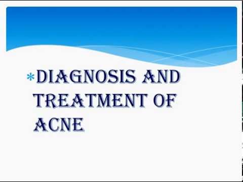 diagnosis and treatment of acne