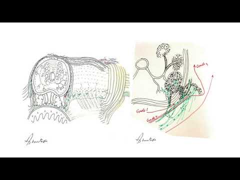 Dept. of Urology Multidisciplinary Prostate Cancer Treatment Program