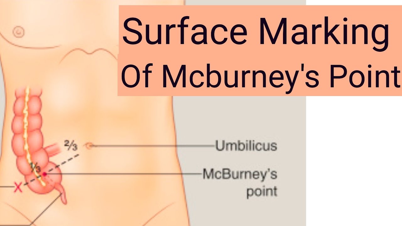 Surface Marking of Mcburney's Point || Anatomy of Mcburney's Point ||
