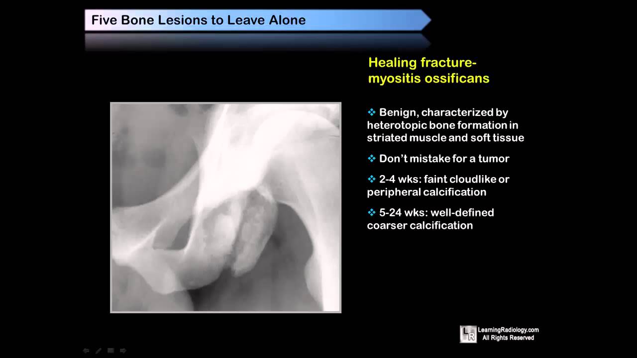 The Official LearningRadiology.com (TM) Channel