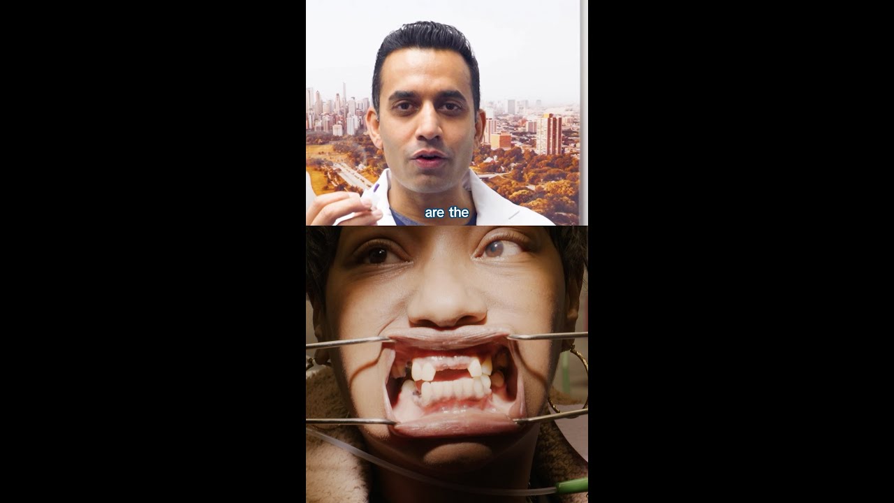 Single Tooth Dental Implants: Everything You Need To Know